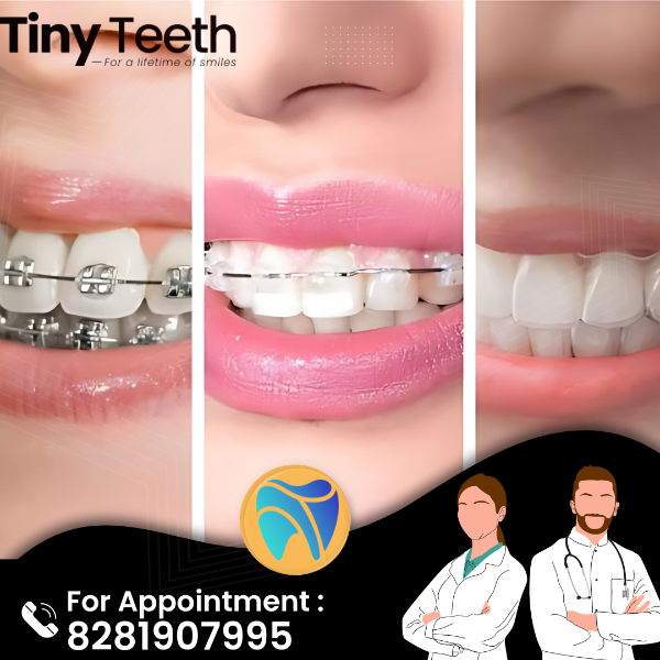 TINY TEETH DENTAL CLINIC | Best DENTAL CLINIC Service in North Paravur, Ernakulam
