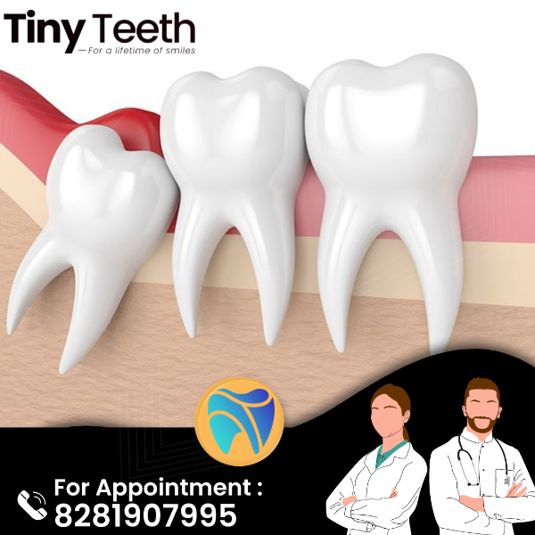 TINY TEETH DENTAL CLINIC | Best DENTAL CLINIC Service in North Paravur, Ernakulam